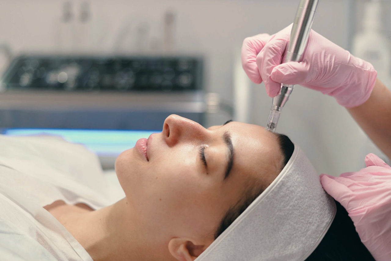 Microneedling with PRP Scottsdale | Platelet Rich Plasma